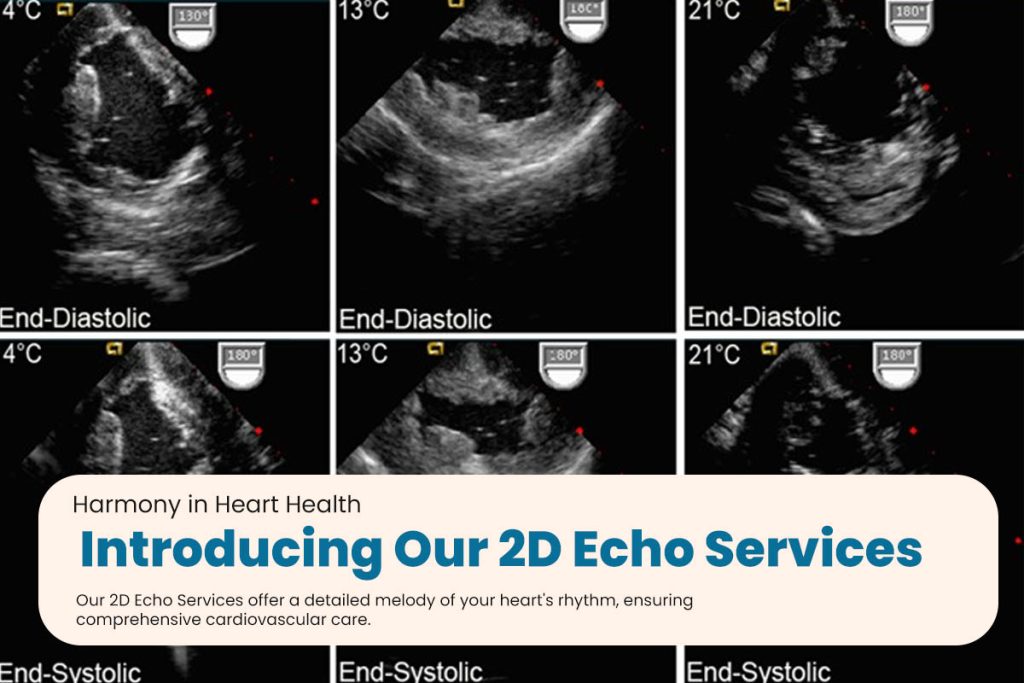 2D Echo in South Delhi by Dr. Rupali's Medical & Diagnostics