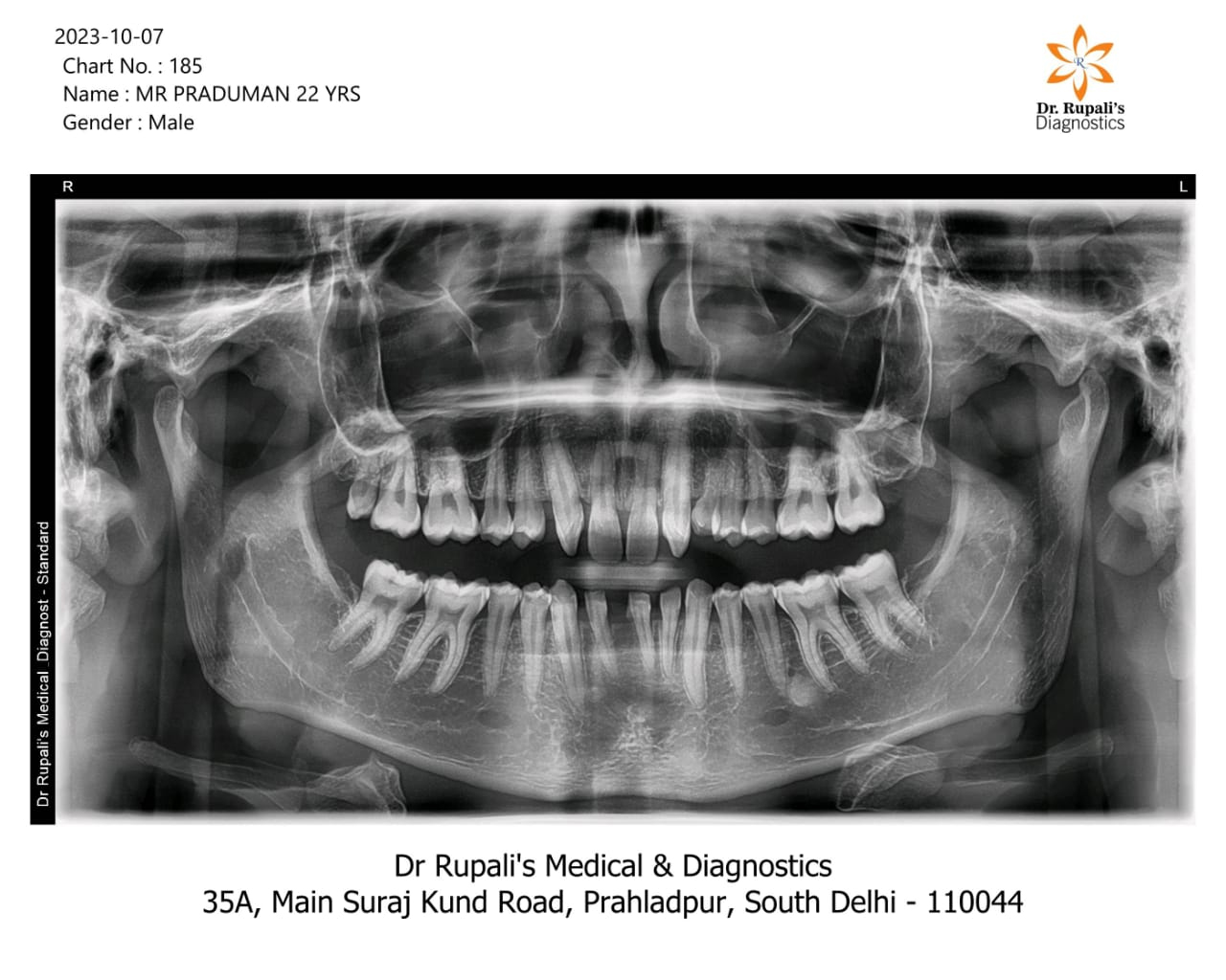 OPG Dental X-Ray in South Delhi at Dr. Rupali's Medical