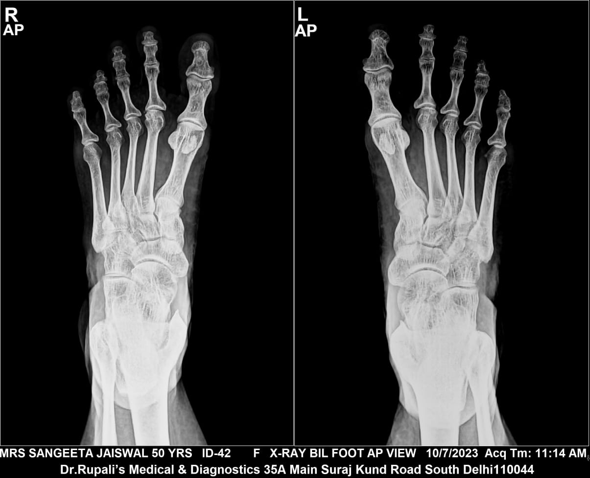 Digital X-ray at Home in South Delhi, Faridabad & Gurugram